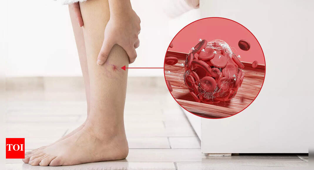 You know what’s a heart attack. But a leg attack? | India News - Times ...