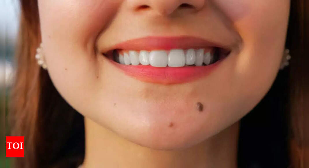 Moles that will make you rich - Times of India