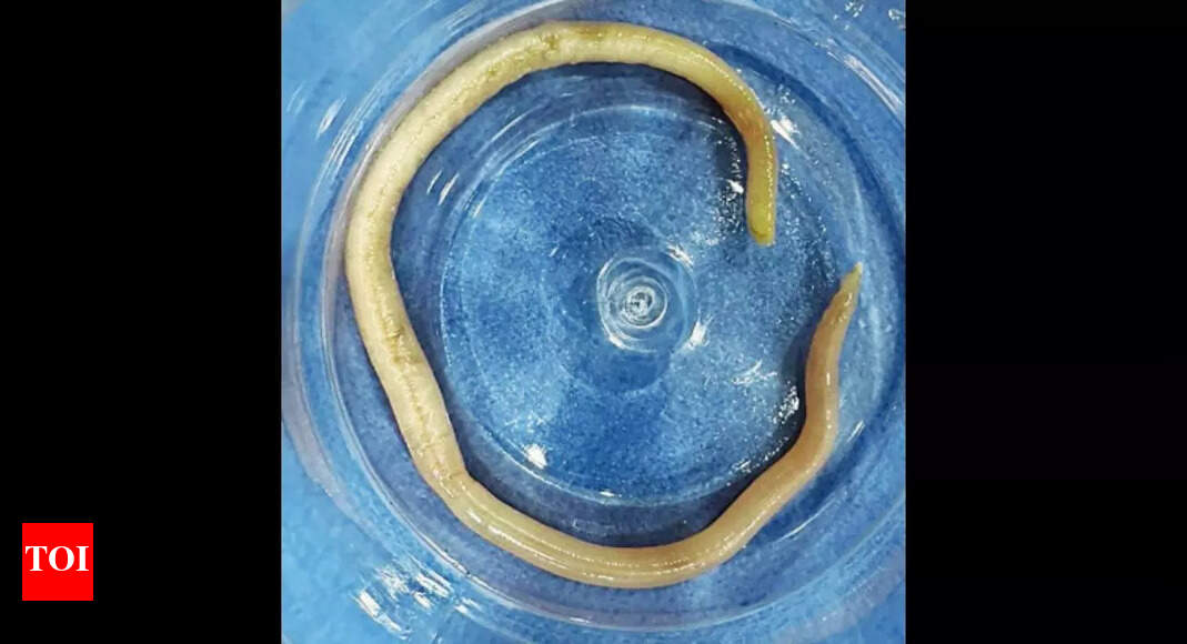 Worm: Woman Rushed To Hosp Over Stomach Pain; Live 17cm Worm Found In ...