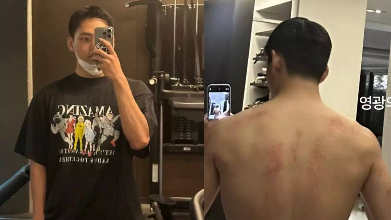 BTS’ V Proudly Flaunts His 'Wounds Of Glory' And Muscular Physique ...