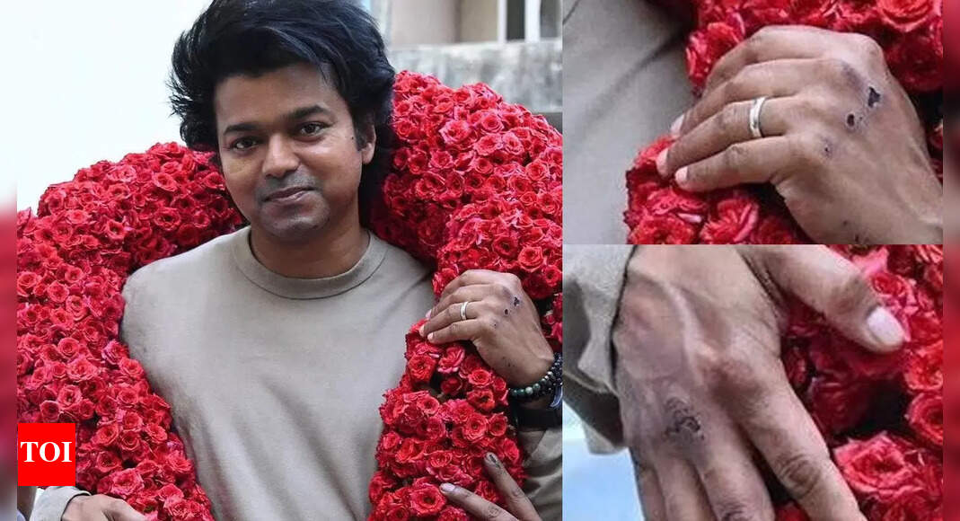 Thalapathy Vijay spotted with injuries, deets inside | Tamil Movie News ...