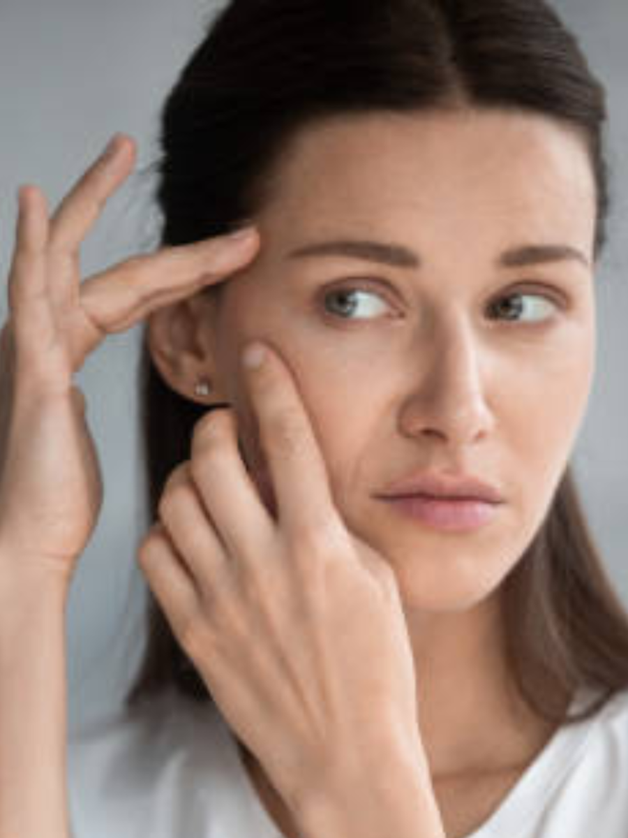 Home Remedies For Anti-Aging: Tips To Get Rid Of Wrinkles Naturally ...