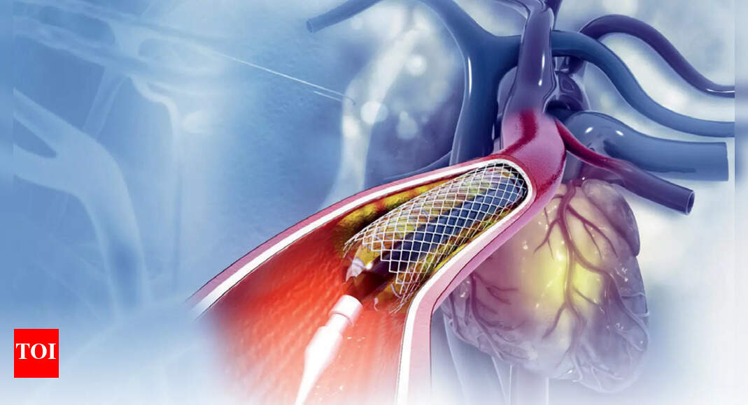 Stent-for-bribe racket at Delhi hospital reveals stents 'overkill ...