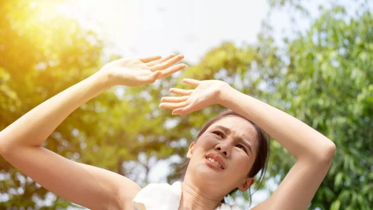 10 Effective Home Remedies For Treating Sunstroke