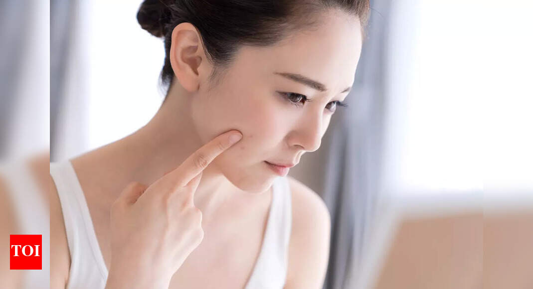 Chinese Beauty Trends: Bird poop facial to fire facial these bizarre ...