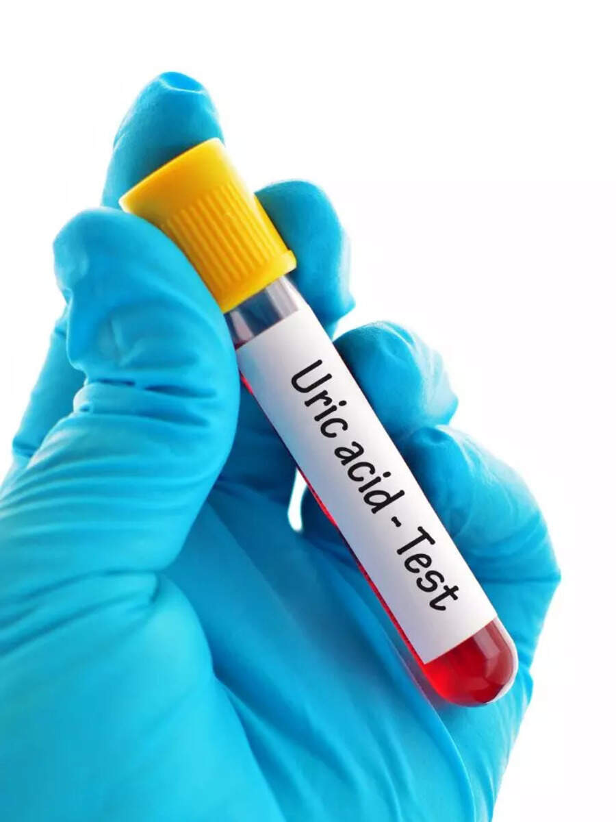 8 Foods That Help To Reduce Uric Acid Levels | Times Now