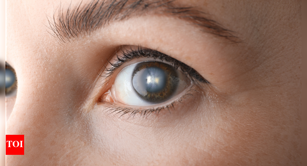 Cataract Ayurvedic Remedies: Ayurvedic remedies and eye exercises for ...