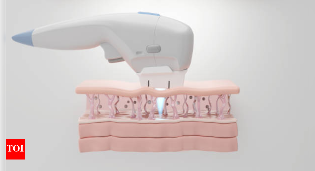 What is Ultherapy? Everything about the non-invasive skin tightening ...