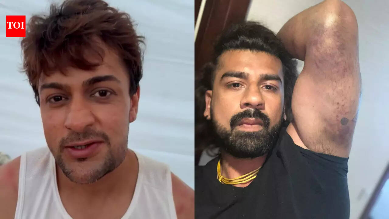 From Shalin Bhanot to Aashish Mehrotra; celebs who got injured while ...