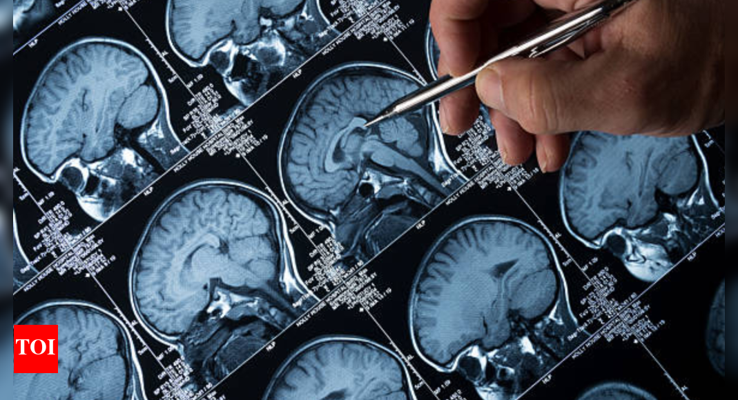 Brain aging: Expert explains causes and how to reduce impact of ...