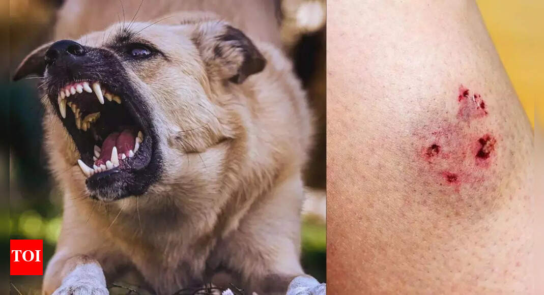Dog bite death 'accidental', fit for insurance payout: Consumer panel ...