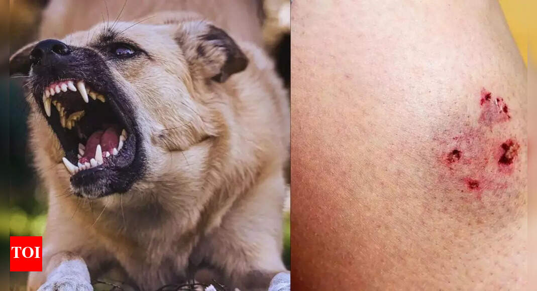 File Stray Dog Bite Complaints and Jab Requests on BMC App | Mumbai ...