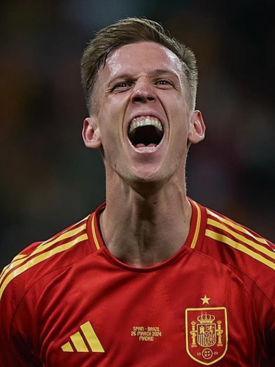 Breakthrough Stars Of UEFA Euro 2024 | Times Now