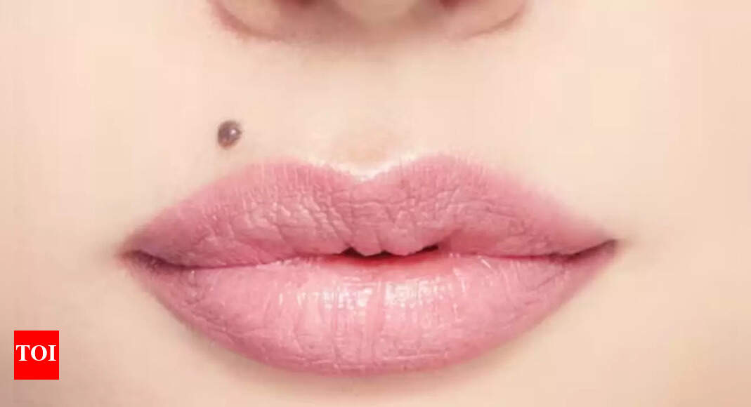 Body Moles: Meaning, Significance, Types and Astrological ...