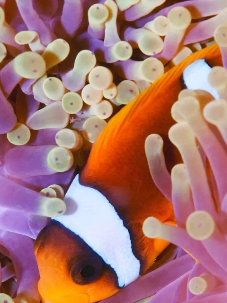 8 animals that don't have a brain | Times of India