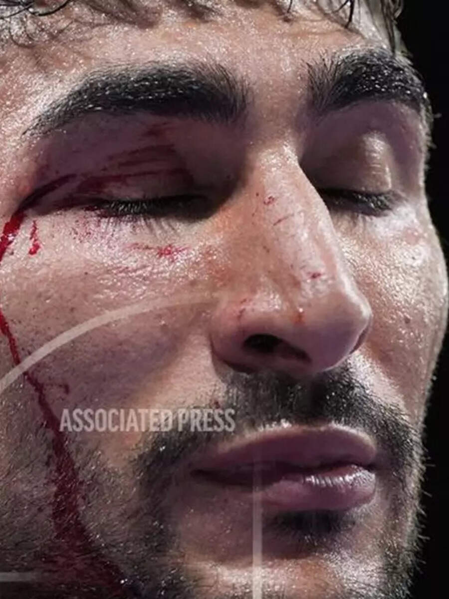 10 Shocking Injuries During Olympic Games | Times Now