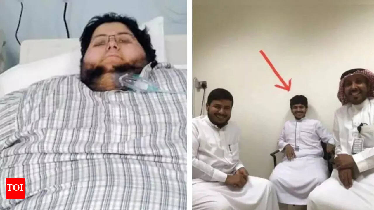 Worlds Fattest Man 2024