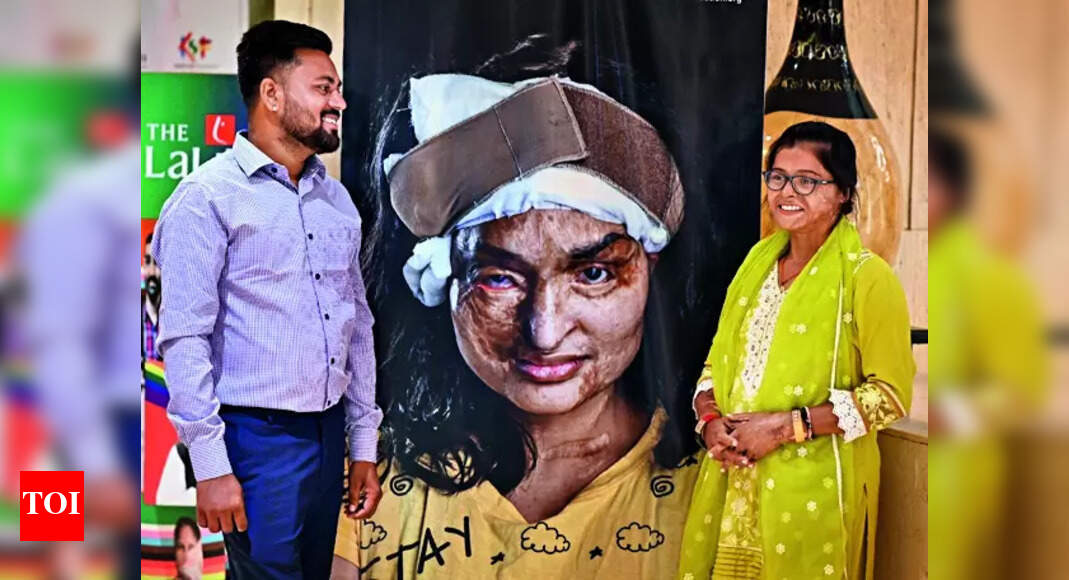 Survivors: Survivors of Acid and Burn Injuries Find Love and Strength ...