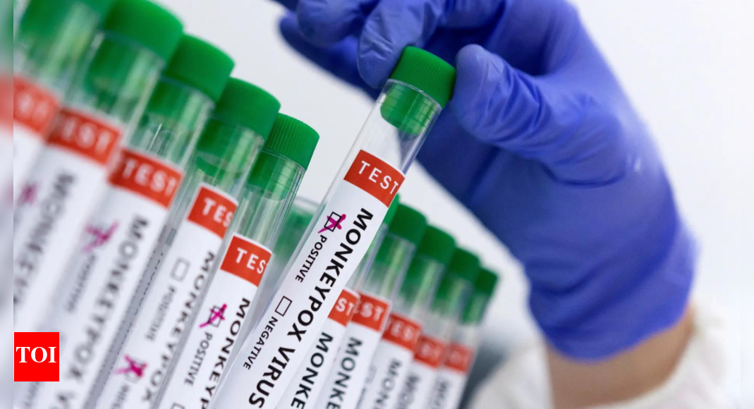 Government Directs Top Labs to Prepare for Early Diagnosis of Monkeypox ...