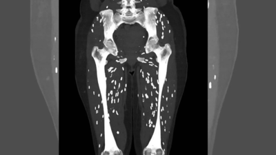 Google: 'One of the craziest CT scans': Doctor shares pictures of ...