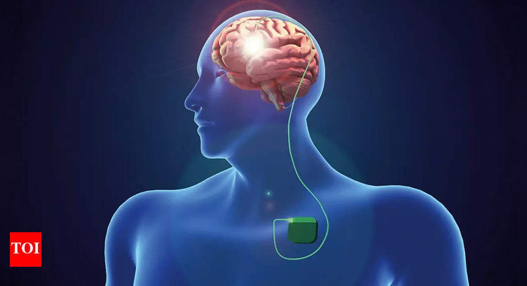 How a ‘pacemaker’ for the brain fights off Parkinson’s - Times of India