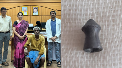 Coimbatore Medical College Hospital (CMCH) doctors perform critical ...