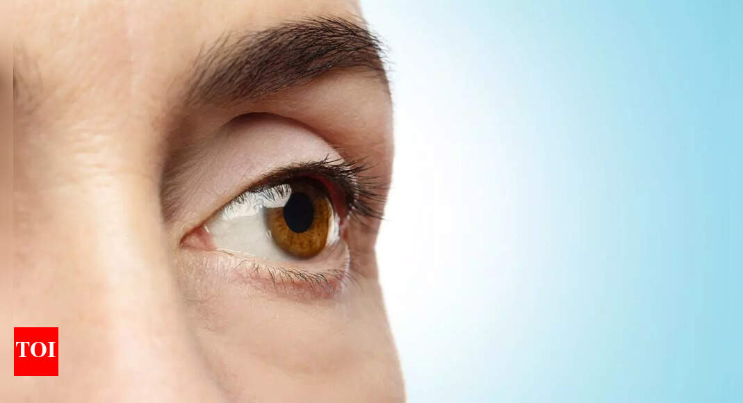 7 surprising reasons behind your puffy eyes and what to do about them ...