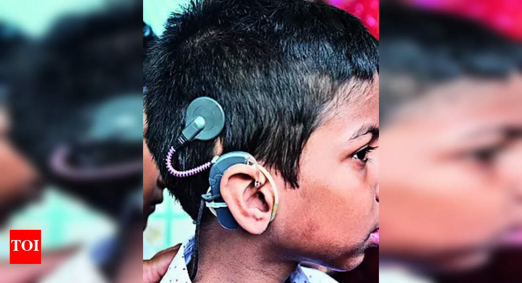 Cochlear Implant: Revolutionary Cochlear Implant Surgery at PGI ...