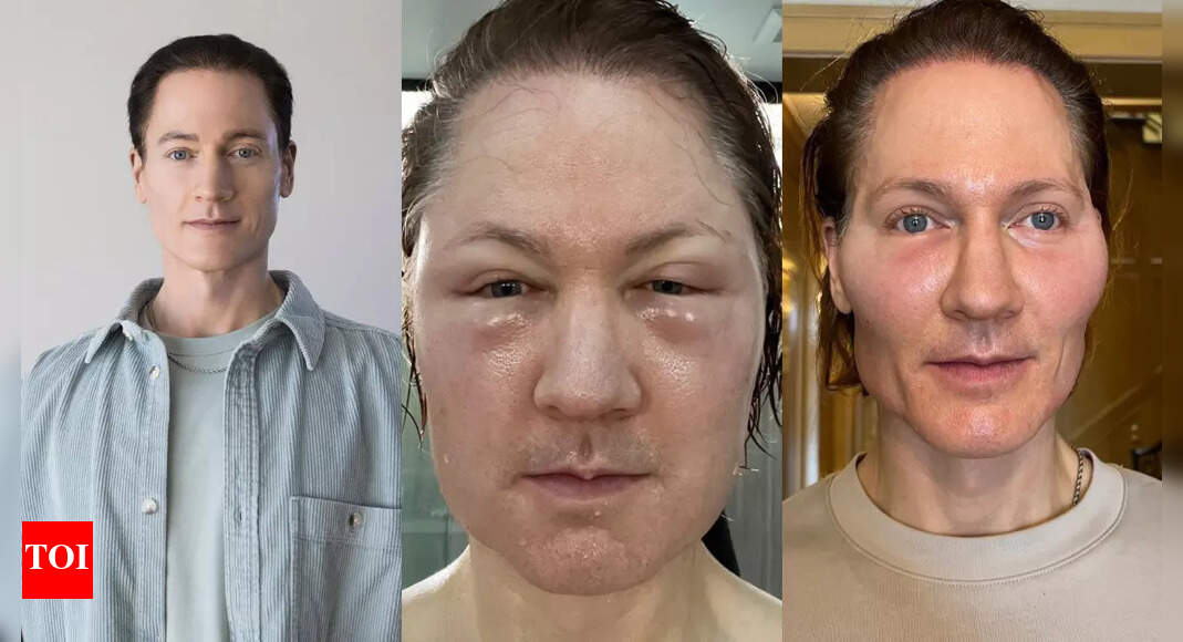 Millionaire’s age reverse therapy goes wrong, says ‘you may not ...