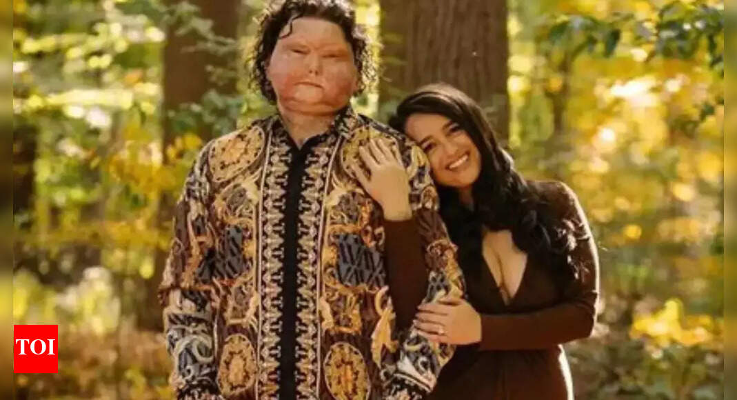 Meet Joe DiMeo the first man to undergo a face and double hand ...