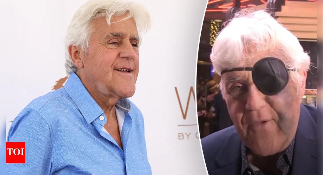 Jay Leno arrives at the comedy show with an injured face and an eye ...