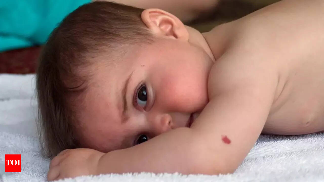 Red Spots On Baby S Eyebrows Meaning Spiritual - Infoupdate.org