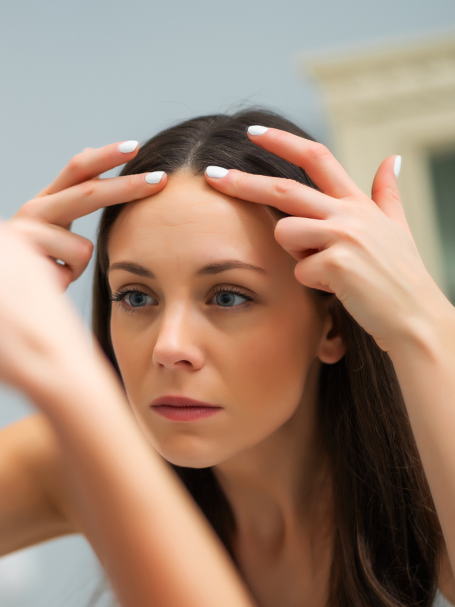 9 Ways to Get Rid of Dark Forehead | Times Now