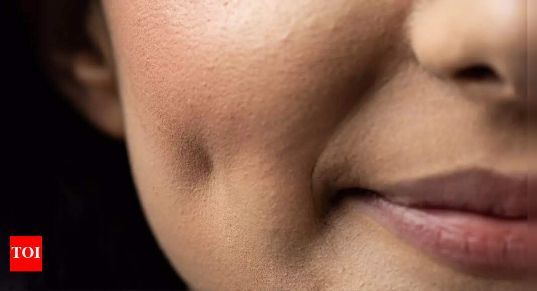 The science behind dimples: Why do we adore these 'defective' muscles ...