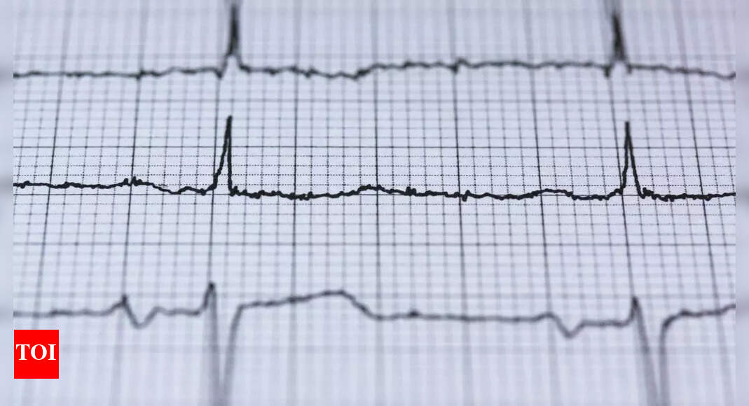 Portable ECG Machines For Home Use: For Convenient Heart Monitoring ...