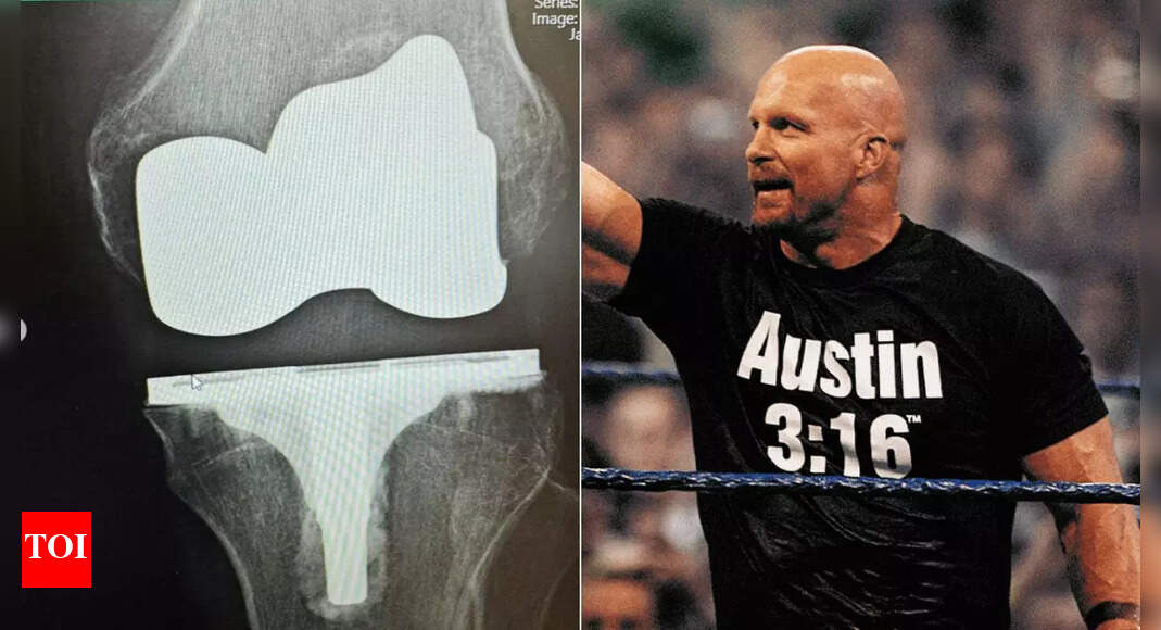 Steve Austin’s Knee Surgery Update: “Stone Cold” Opens Up about Mint ...