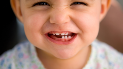 Bottle and breastfeeding: How to prevent early tooth decay - The Times ...