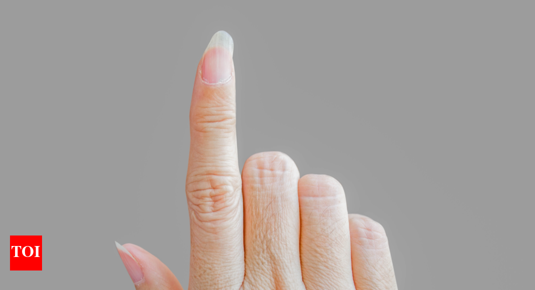 6 nail changes one should get examined by the doctor urgently - The ...
