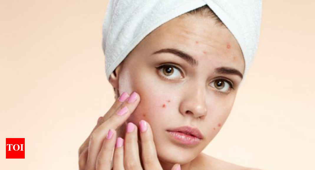 Does facial acne mapping improve your skin health? - The Times of India