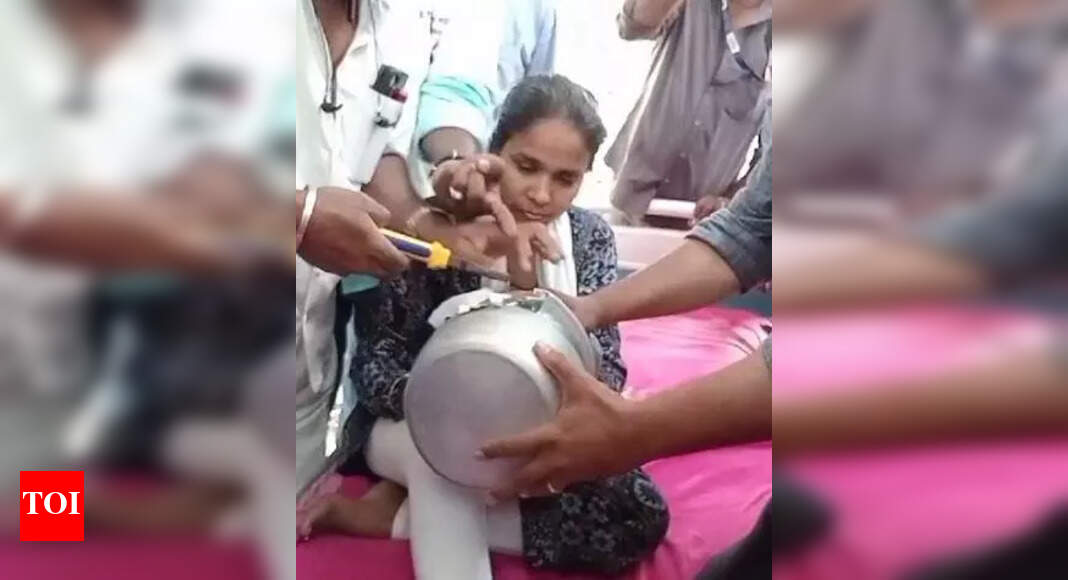 Child’s head gets stuck in vessel, doctors free it | Chennai News - The ...