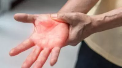 8-year-old with GBS nursed back to life at Rae Bareli AIIMS | Lucknow ...