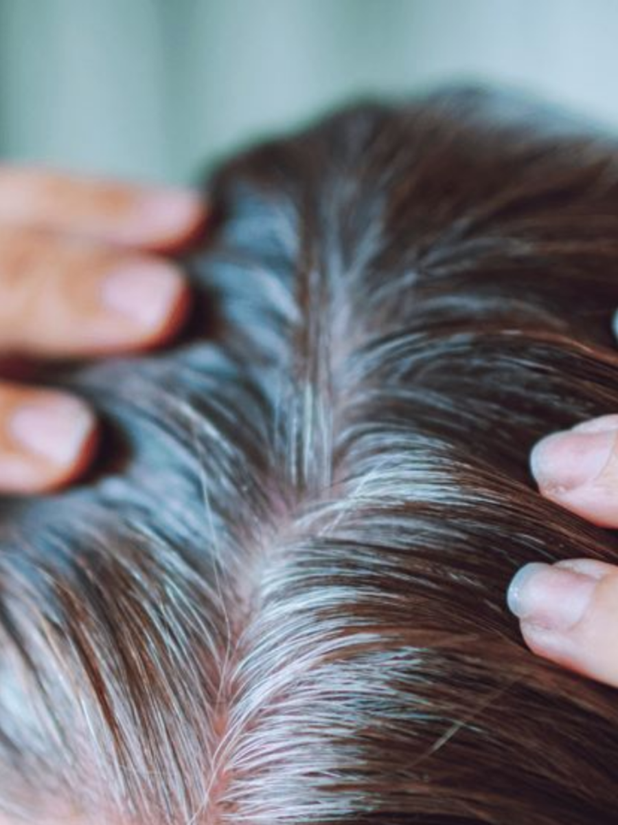 Premature grey hair: Dos and don'ts to bid goodbye to premature grey ...