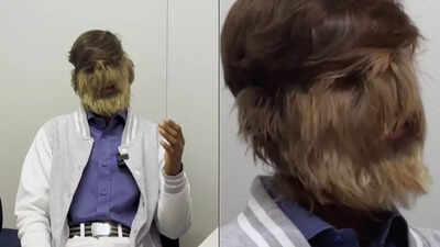 Indian boy with 'werewolf syndrome' sets Guinness World Record for ...