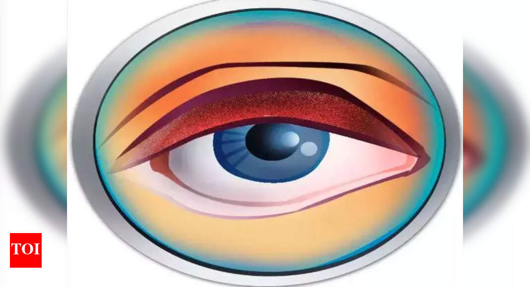 Surgery that reduces pupil to pinhole offers alternative to corneal ...