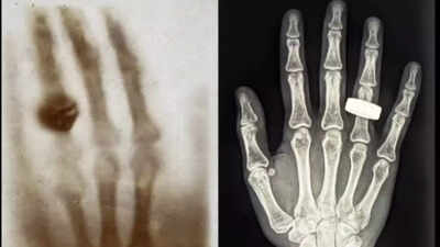 SpaceX's Fram2 mission achieves first-ever human X-Ray in space orbit ...