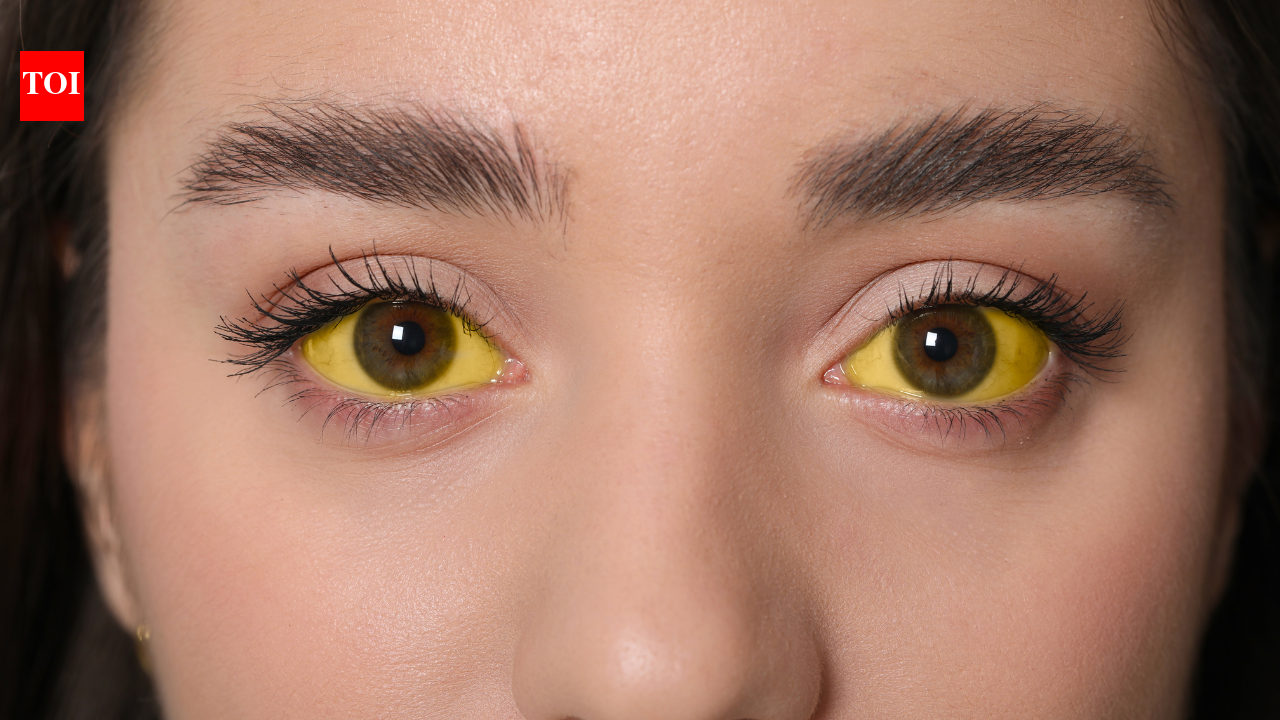 5 things your eyes can tell about your liver health