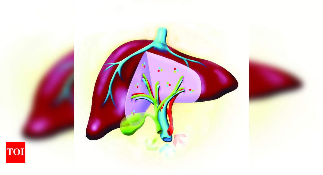 Doctors sound alarm, point to ‘explosion’ of non-alcoholic fatty liver ...