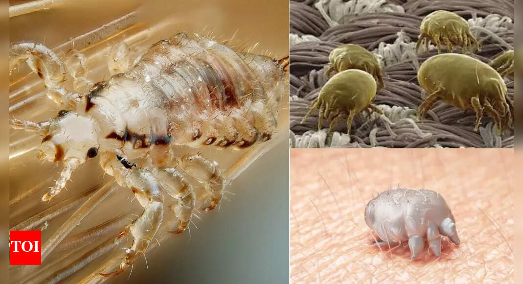9 insects that reside on human body for their survival | - Times of India
