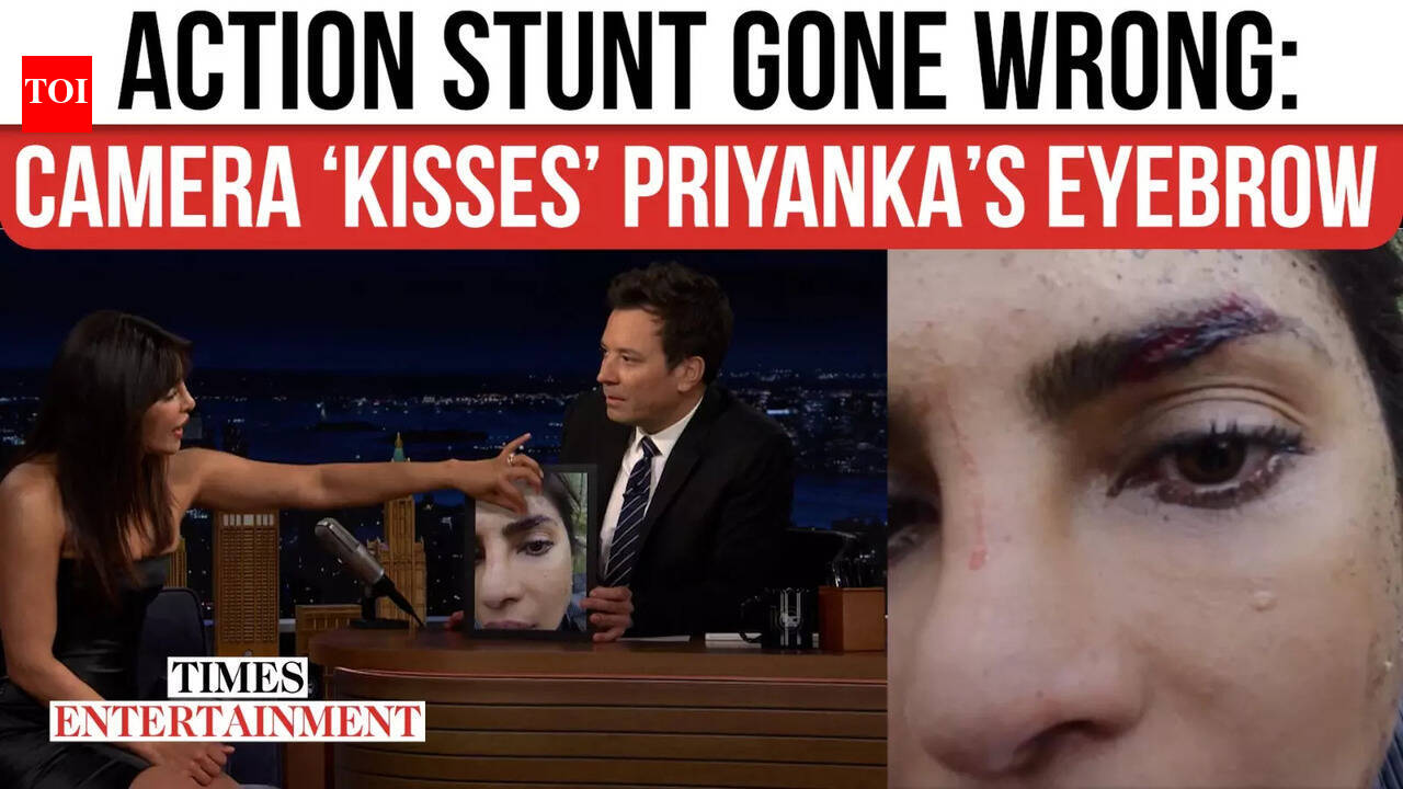 PRIYANKA CHOPRA INJURED ON SET| CAMERA RIPS HER EYEBROW IN STUNT GONE WRONG