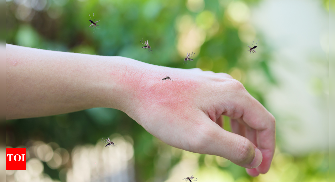 Why viral fevers, dengue, and typhoid surge during monsoons - Times of ...